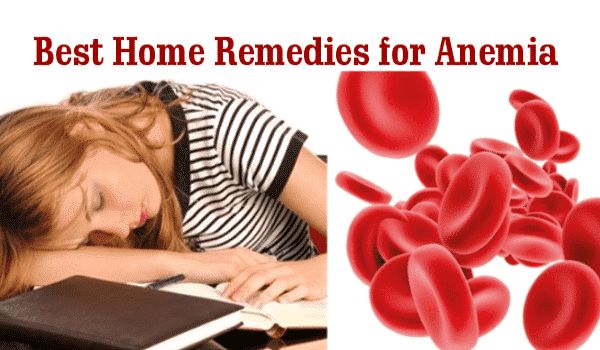 Anemia Symptoms 10 Best Home Remedies For Anemia