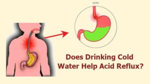 Does Drinking Cold Water Help Acid Reflux?